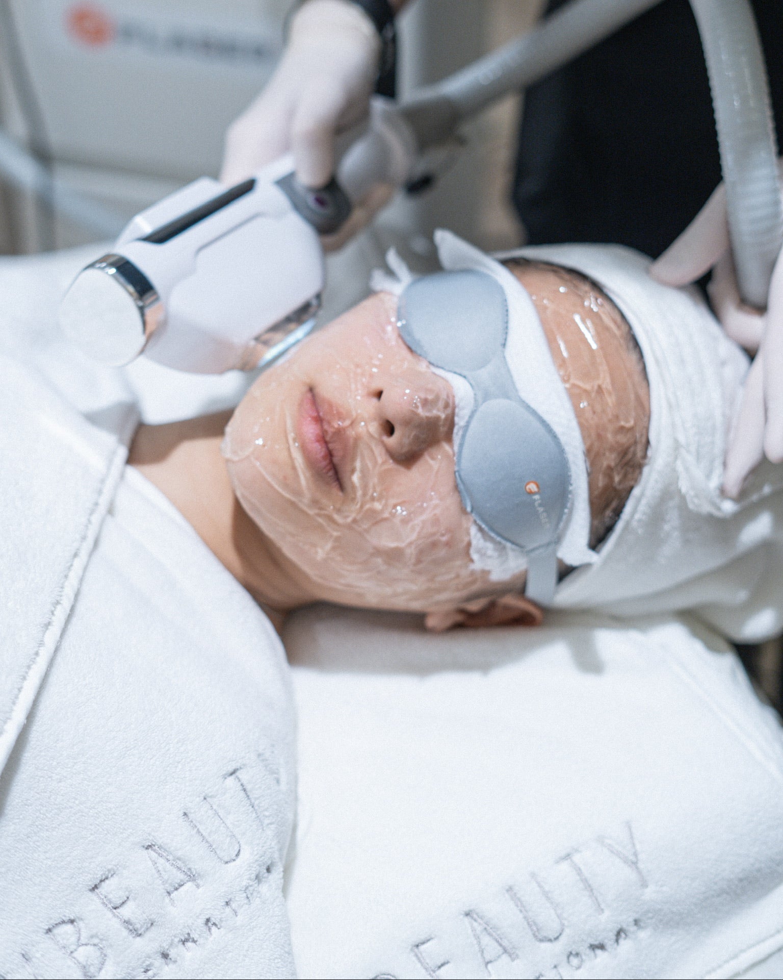DPL Skin Rejuvenation: Your Complete Guide – vbeautyskinclinics